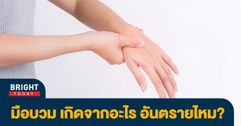 Solve doubts! Pain, swelling, redness, heat, swollen hands and feet for ...